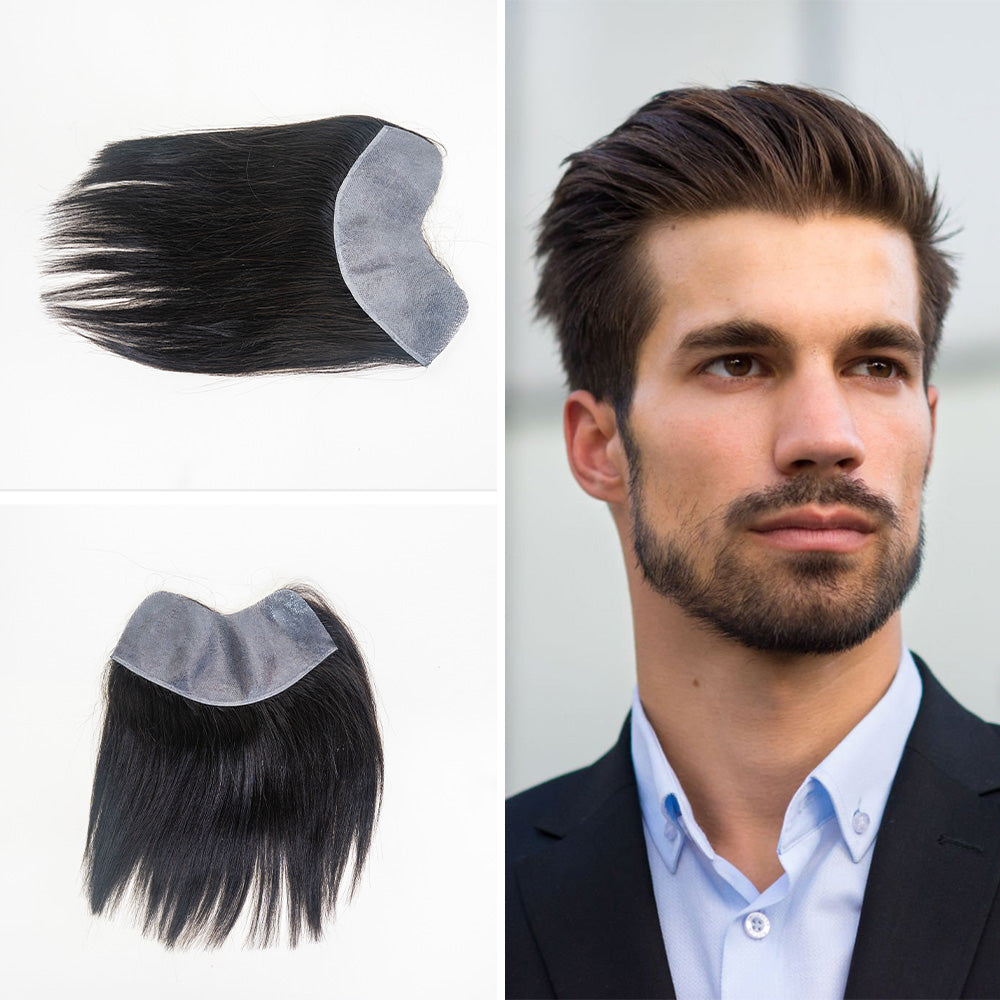 Buy Front Hairline Patch Online Easily and Realistically